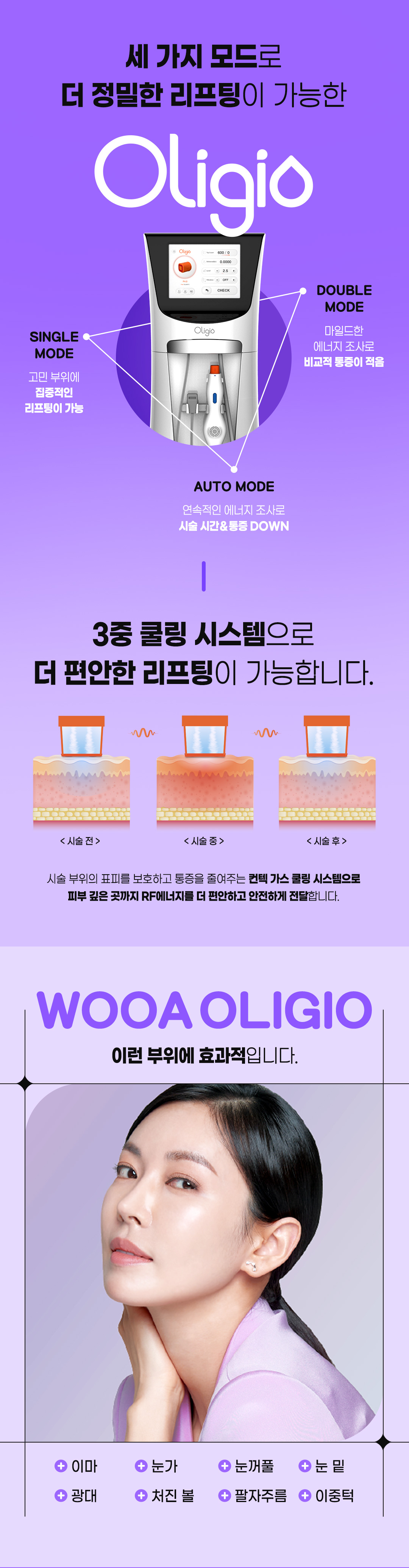 WOOA 올리지오 by 우아성형외과의원 | 강남언니 - 1등 성형수술&피부시술 정보앱