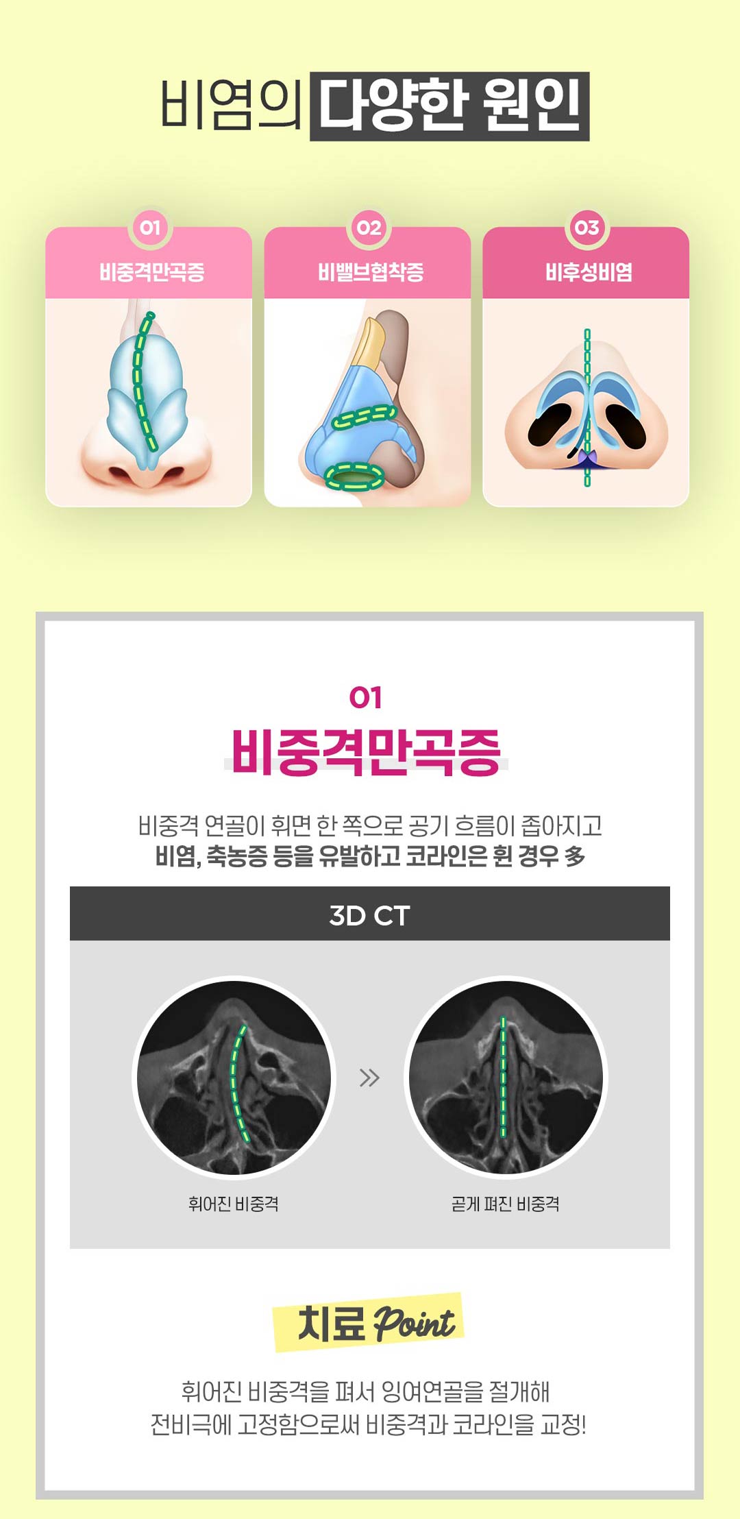 예쁘면 Da야 비염미용코성형 By 디에이성형외과의원 강남언니 1등 성형수술and피부시술 정보앱
