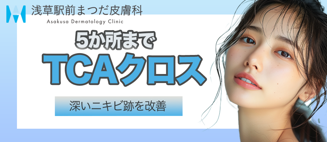 TCAクロス｜5か所まで | 浅草駅前まつだ皮膚科