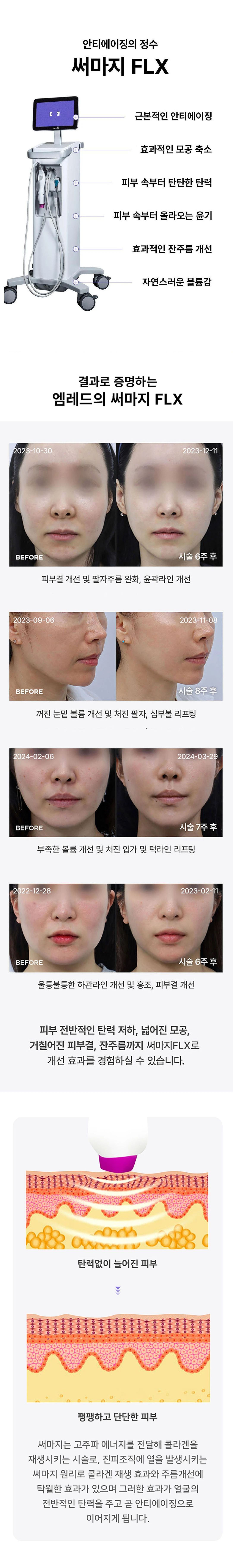 비스포크 써마지 FLX 600샷 by 엠레드의원 | 강남언니 - 1등 성형수술&피부시술 정보앱