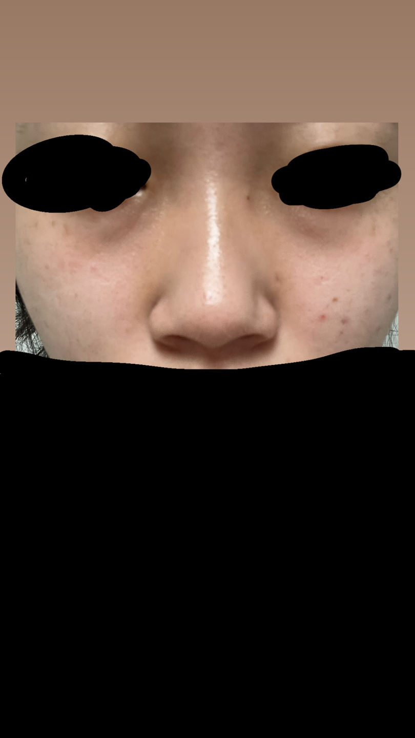 시술 수술 질문 비염 수술 기능코 강남언니 1등 성형수술and피부시술 정보앱
