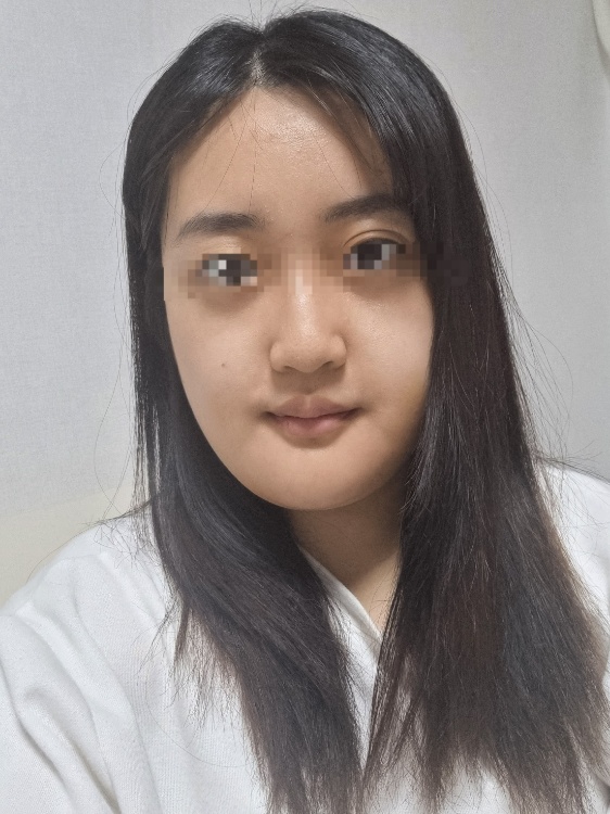 자유수다: 💬나만의 수술후,... | 강남언니 - 1등 성형수술&피부시술 정보앱