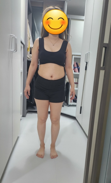 자유수다: 365mc 전신지방... | 강남언니 - 1등 성형수술&피부시술 정보앱