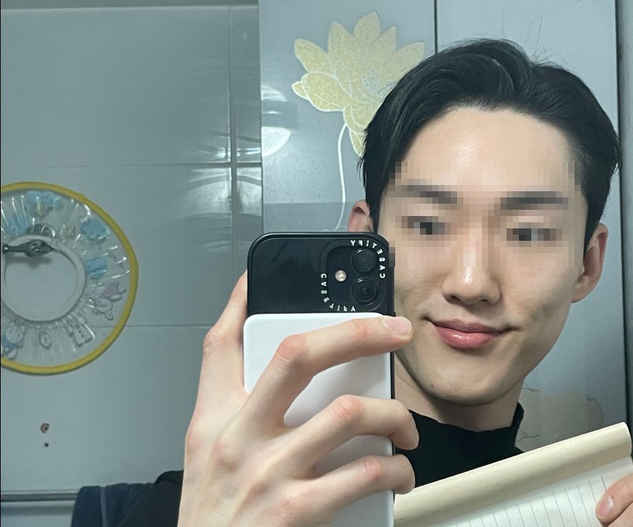 「水光注射」の検索結果 | カンナムオンニ