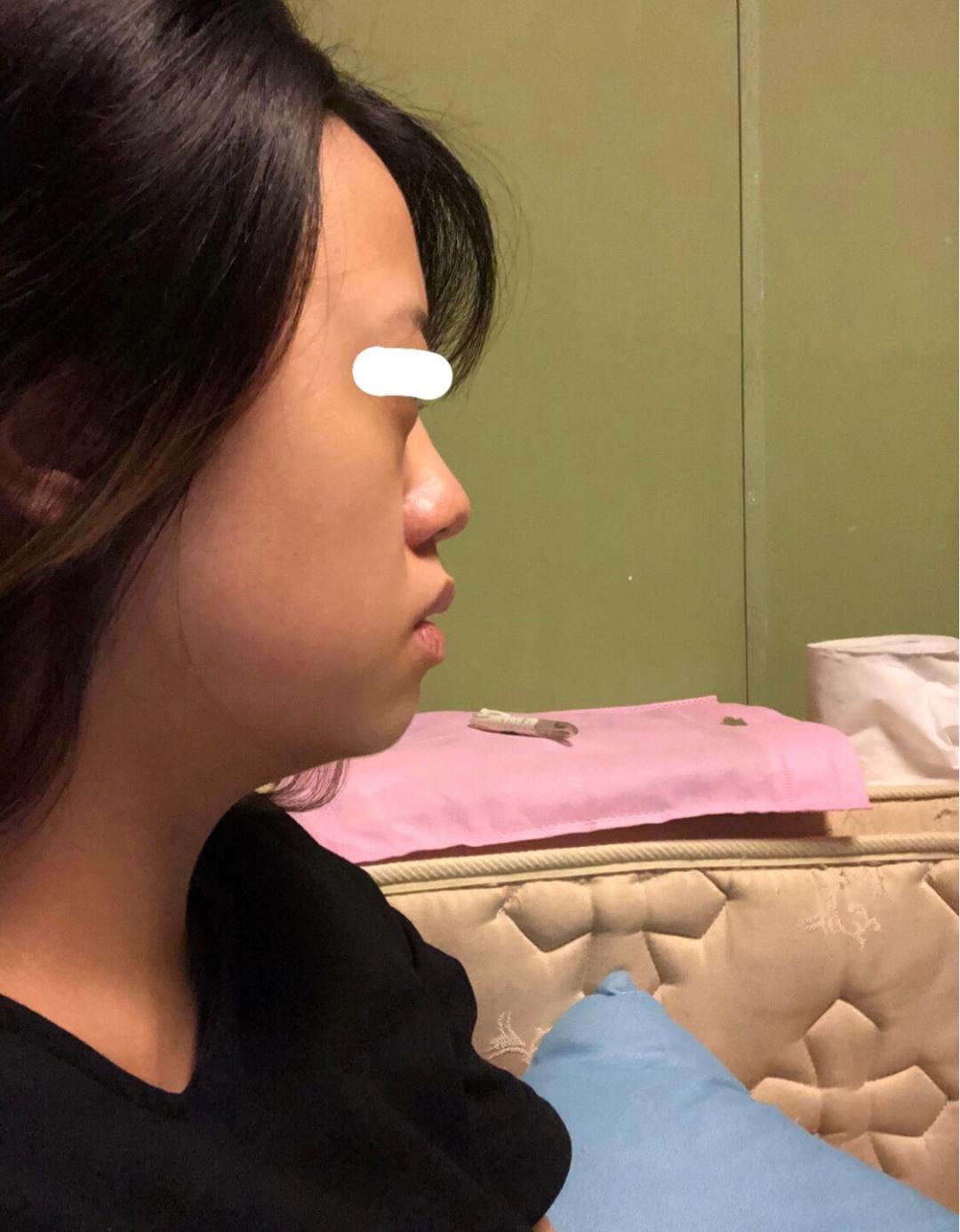 시술 수술 질문 1 2집이 나고 강남언니 1등 성형수술and피부시술 정보앱