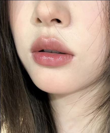 병원질문: 구경하다가 주운 사... | 강남언니 - 1등 성형수술&피부시술 정보앱