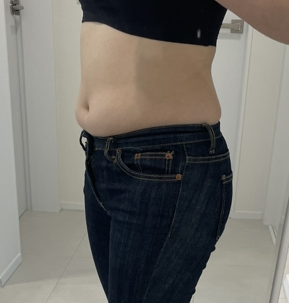 '지방분해주사'에 대한 검색결과 19171개 | 강남언니