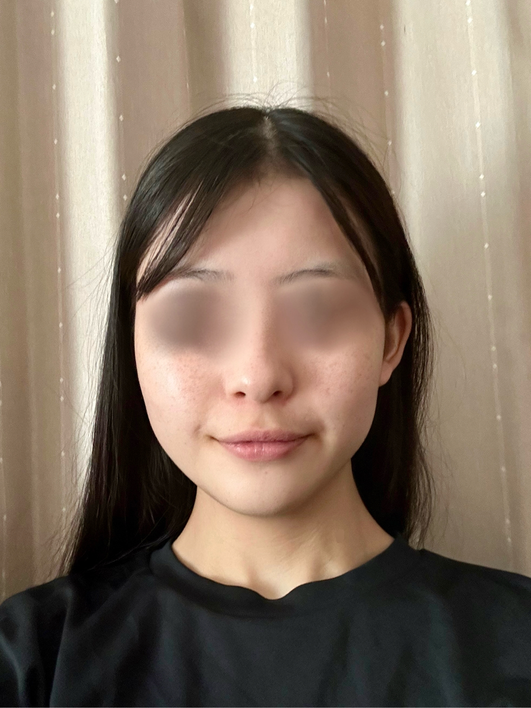 의사에게 물어보세요 한국 여배우 같은 강남언니 1등 성형수술and피부시술 정보앱