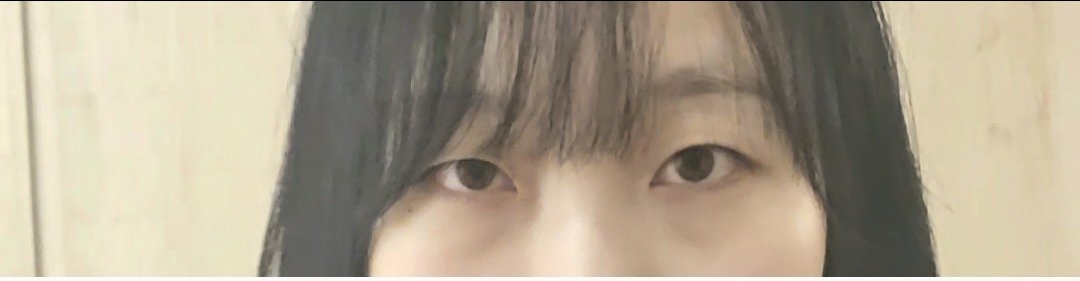 시술 수술 질문 라인고민 ㅠㅠ 속쌍 강남언니 1등 성형수술and피부시술 정보앱