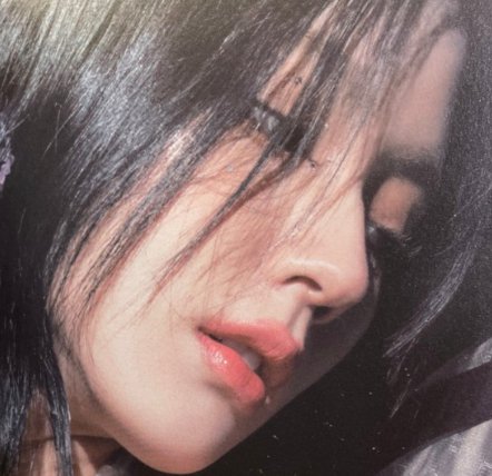 병원질문: 남녀 구분없이 코 ... | 강남언니 - 1등 성형수술&피부시술 정보앱