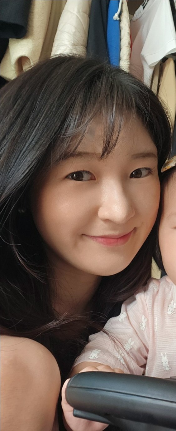 발품후기 속쌍커플이라 항상 강남언니 1등 성형수술and피부시술 정보앱