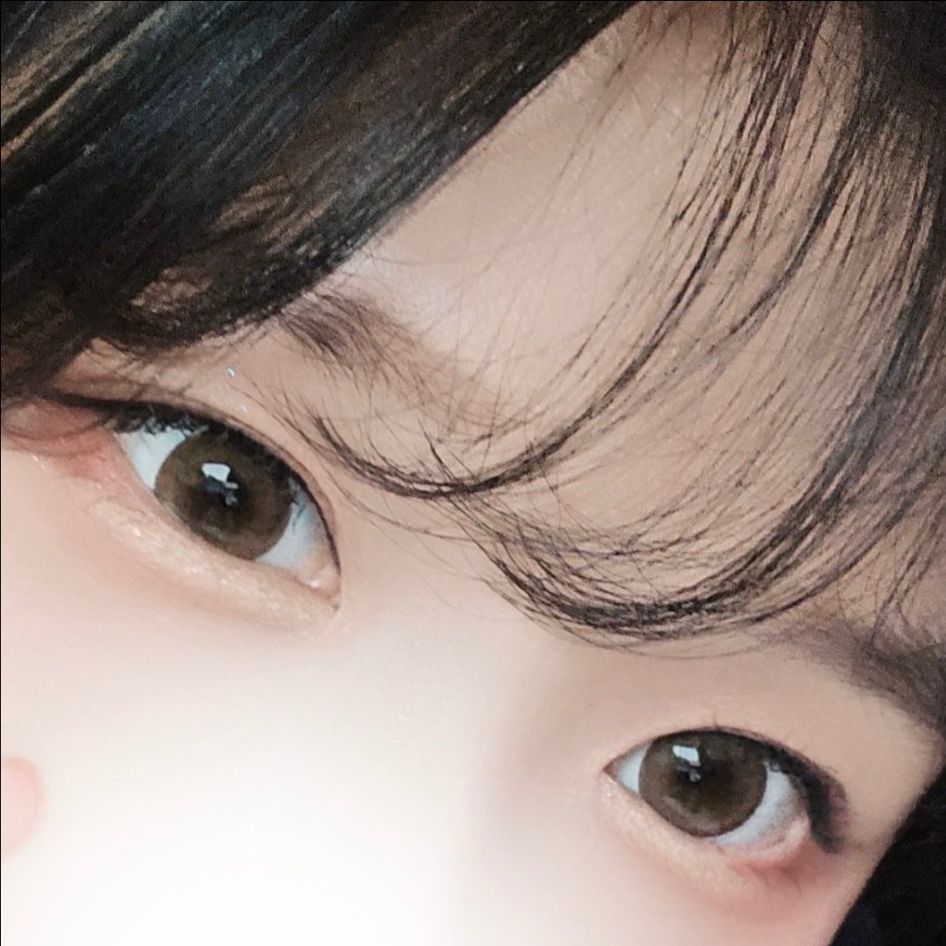 자유수다: 눈성형 실제 후기!... | 강남언니 - 1등 성형수술&피부시술 정보앱