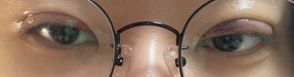 POP美容外科医院の口コミ・料金 | カンナムオンニ