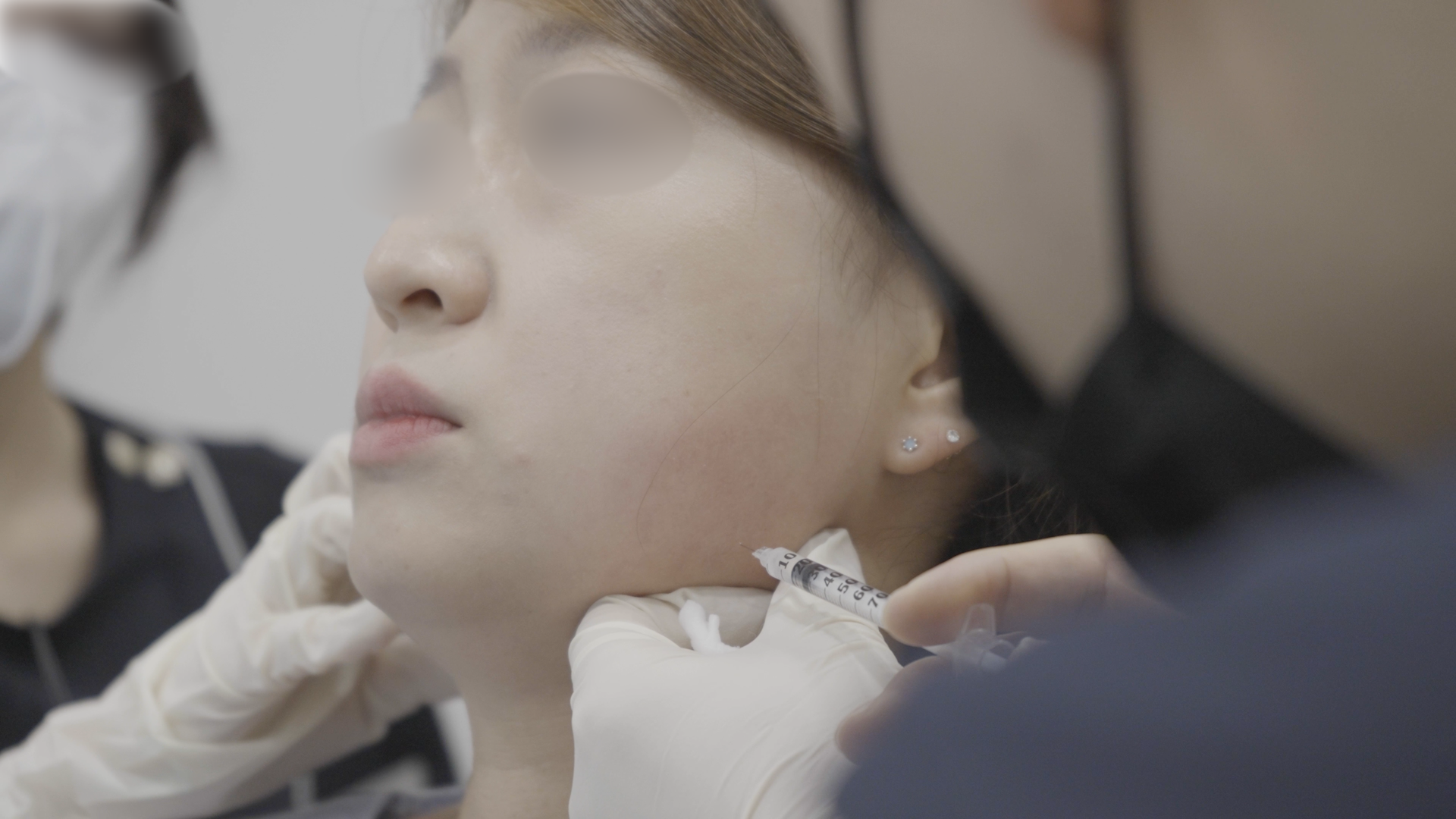 사각턱보톡스에 대한 시술・리뷰・병원 정보2025 강남언니